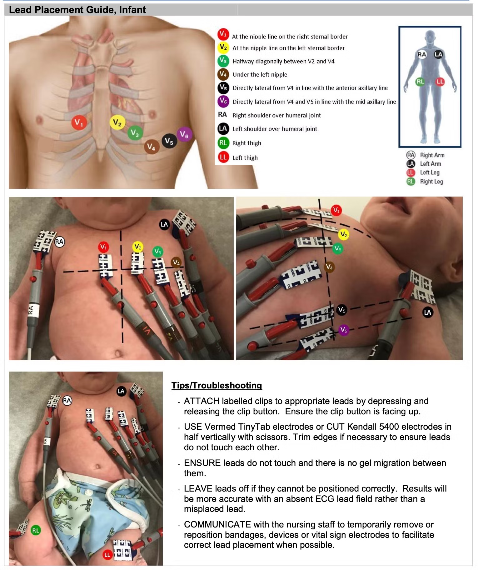 Electrocardiogram ECG CHBC